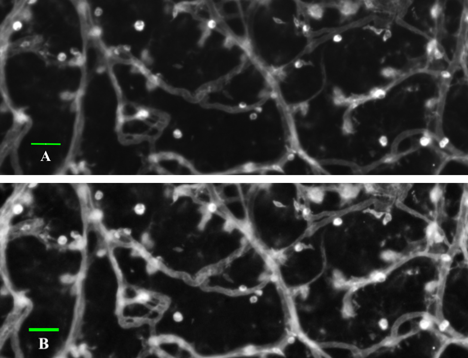 Computational Quantification of Mouse Retinal Vasculature Using ImageJ