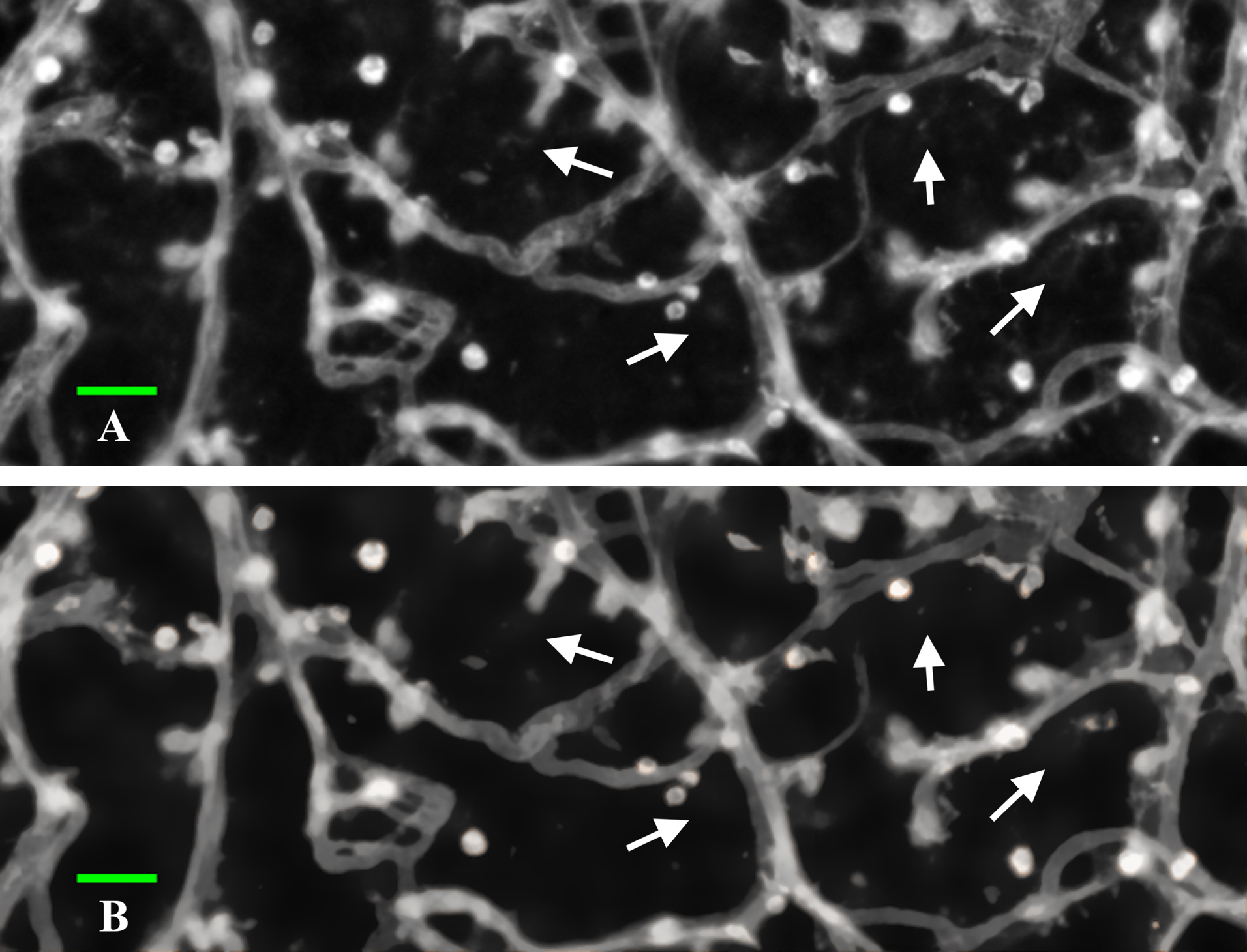 Computational Quantification of Mouse Retinal Vasculature Using ImageJ