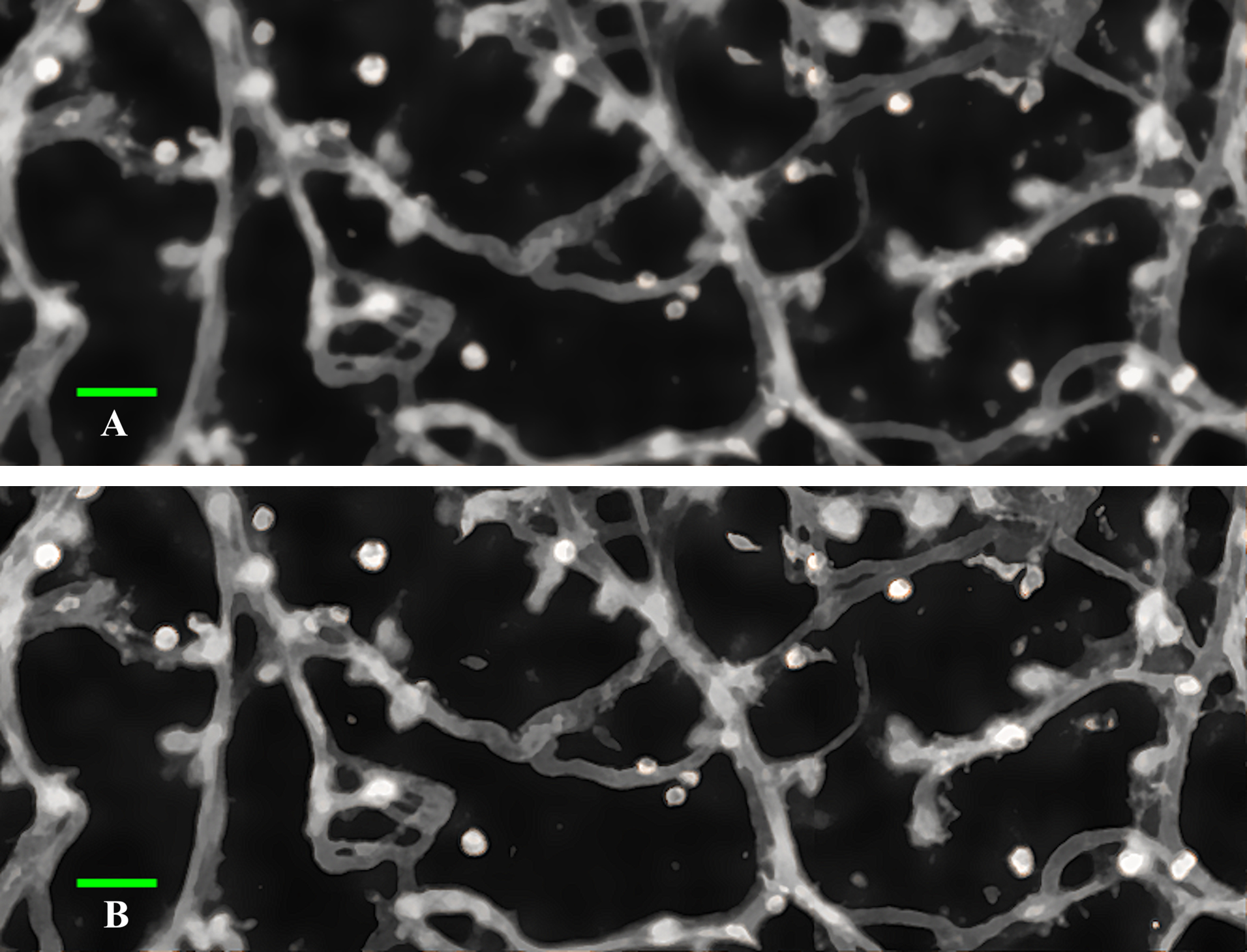 Computational Quantification of Mouse Retinal Vasculature Using ImageJ