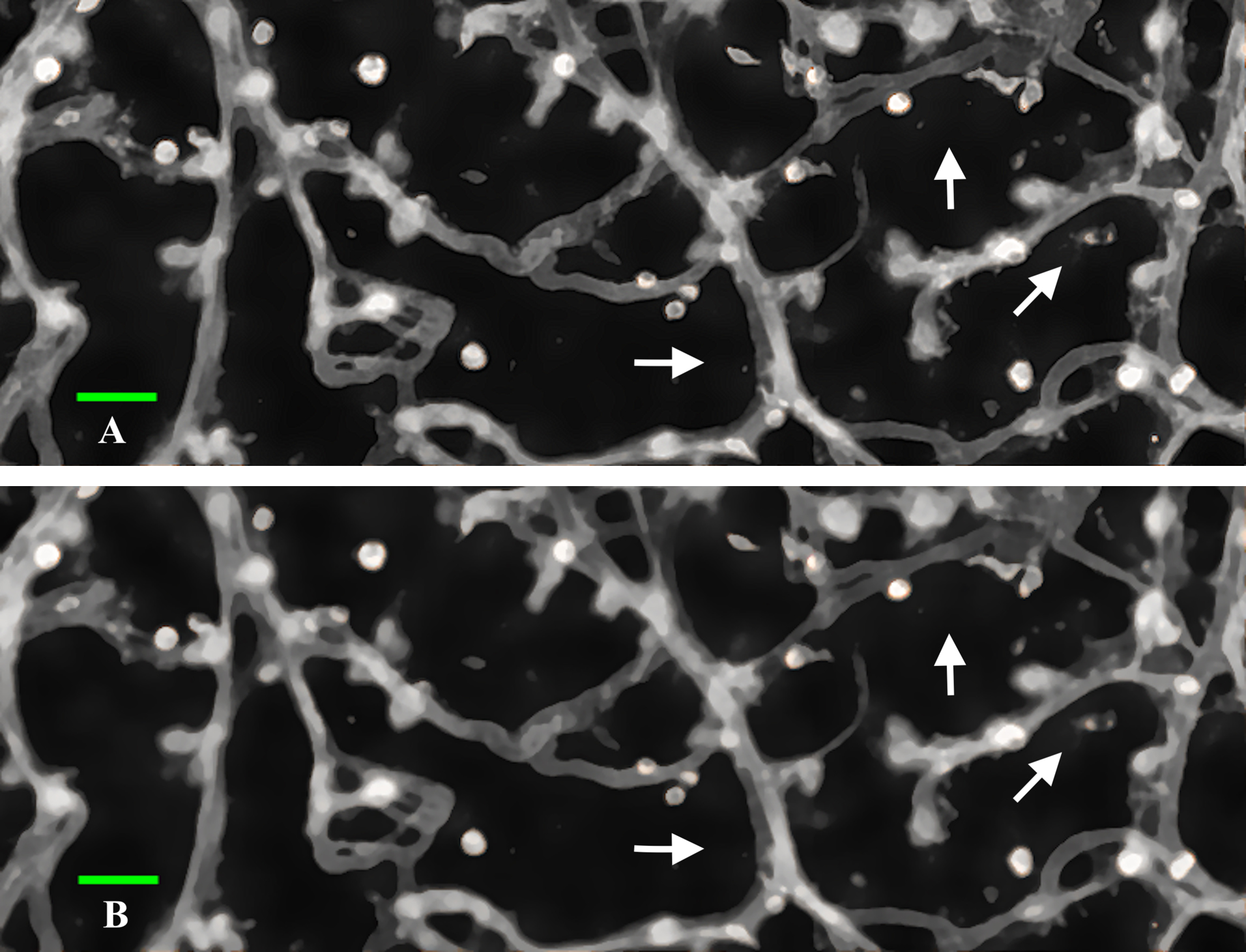 Computational Quantification of Mouse Retinal Vasculature Using ImageJ